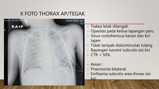 Airway Obstruksi ec Corpal.pptx