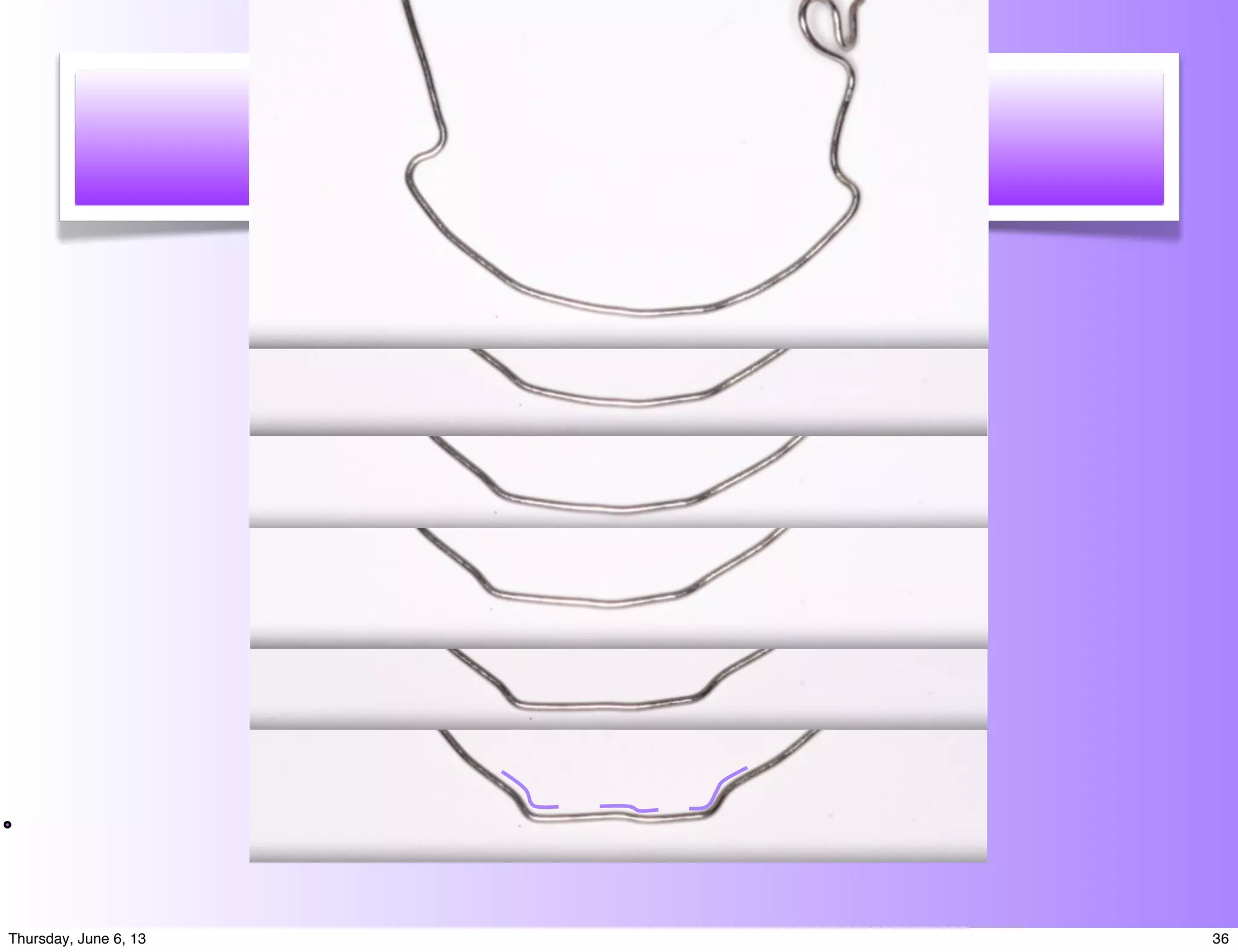 Airway ortho 7 intervening form | PDF