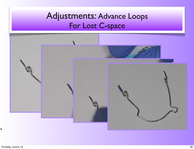 Airway ortho 7 intervening form | PPT