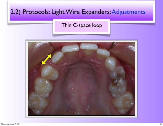 Airway ortho 7 intervening form | PPT