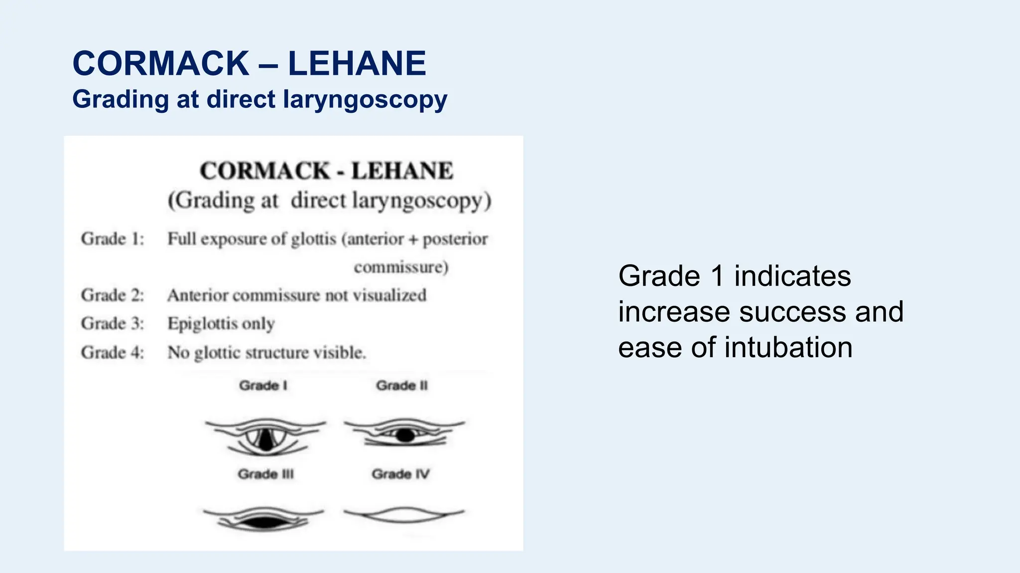 Airway assessment and difficult airway anaesthesia | PPTX