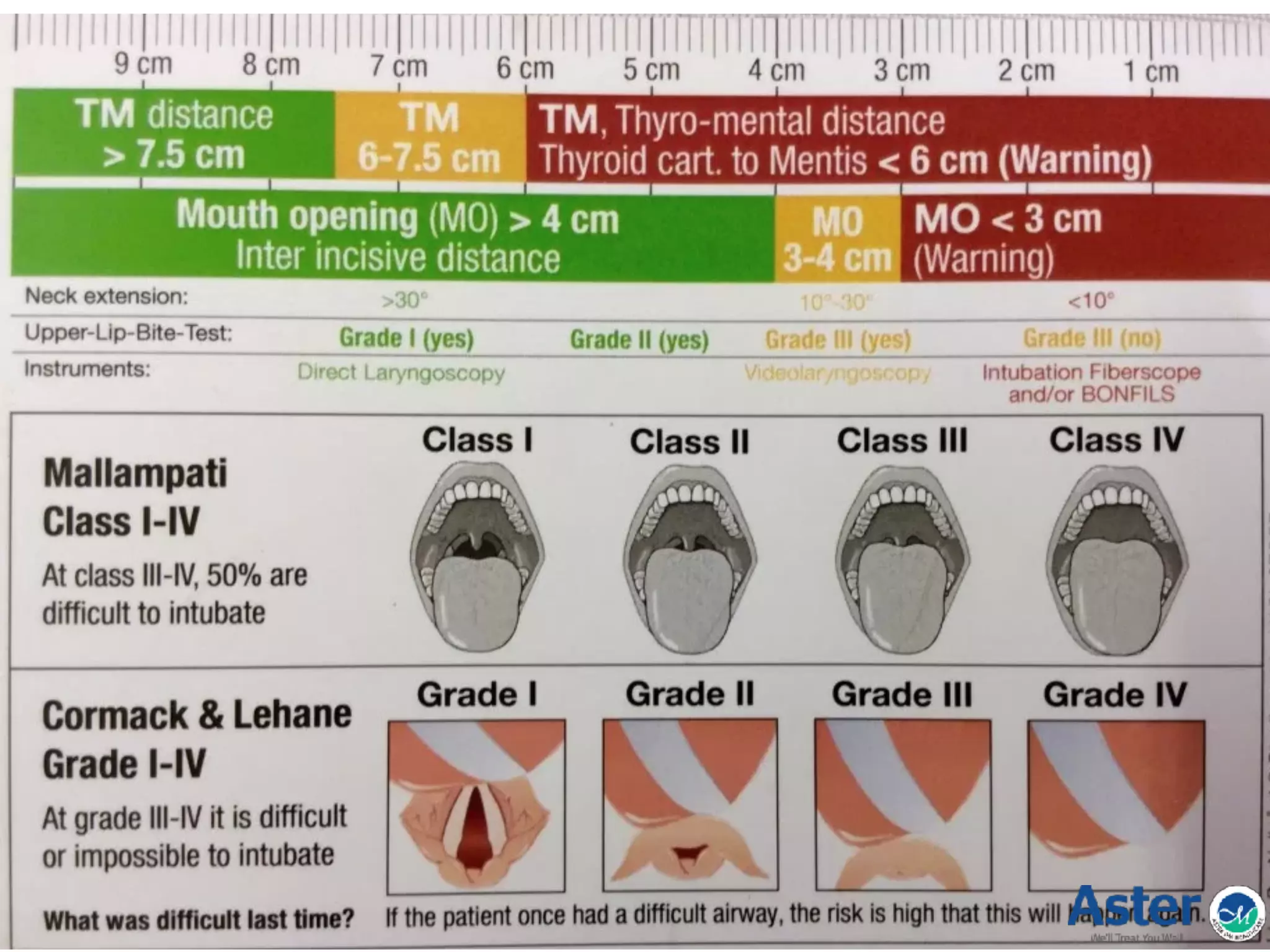 Difficult airway : Made easy | PDF