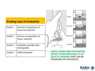 Anterior Larynx Difficult Intubation