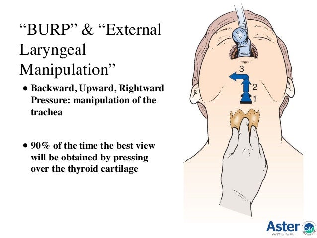 Difficult airway : Made easy