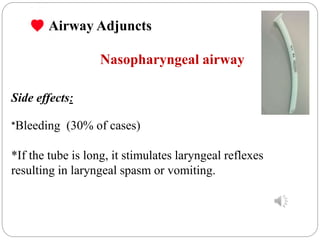 airway management recorded for S2.pptx