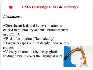 airway management recorded for S2.pptx