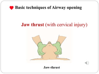 airway management recorded for S2.pptx