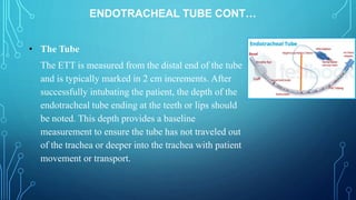 airways and tube Samrth Pareta ppt.pptx