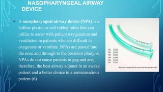 airways and tube Samrth Pareta ppt.pptx