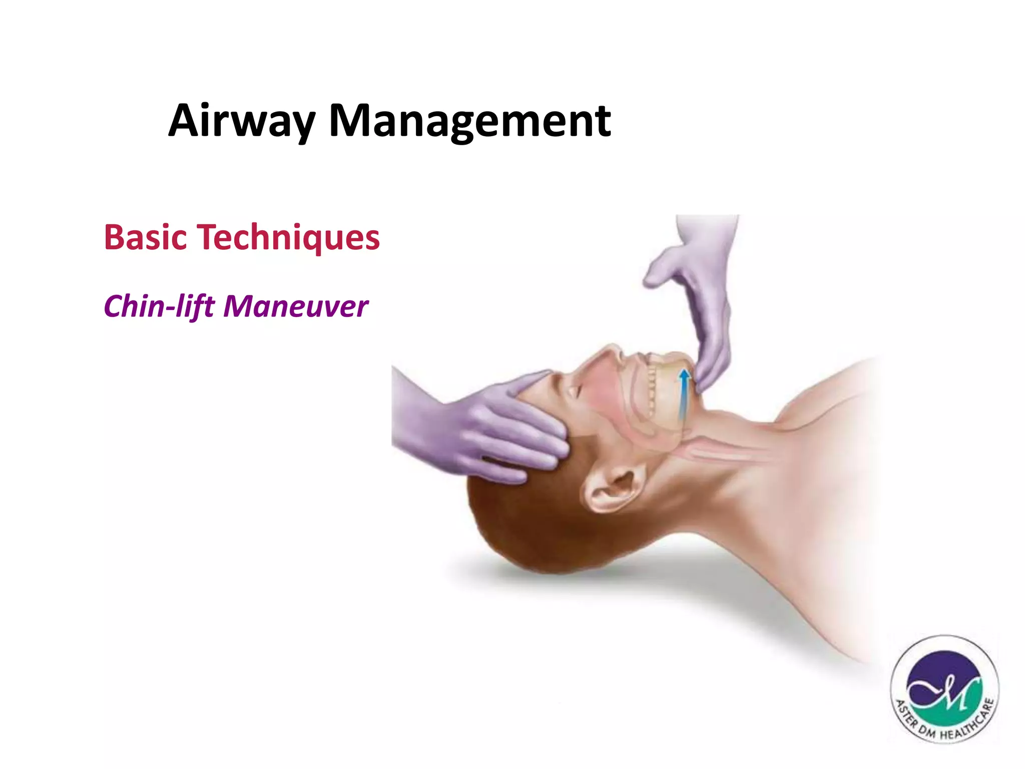 Airway solutions in trauma scenarios | PPTX