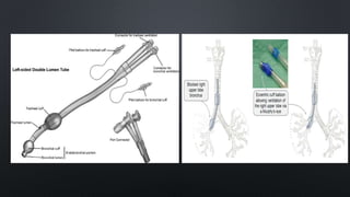 Airway tutorial | PPT