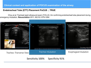 AIRWAY Ultrasound pocus ultrasound slide | PDF