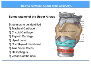 AIRWAY Ultrasound pocus ultrasound slide | PDF