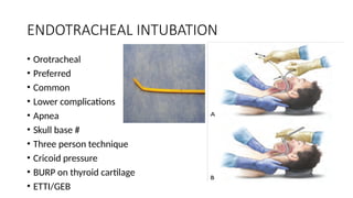 Airway & Ventilatory management by Dr.Mumtaz Ali Narejo.pptx