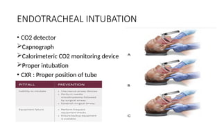 Airway & Ventilatory management by Dr.Mumtaz Ali Narejo.pptx