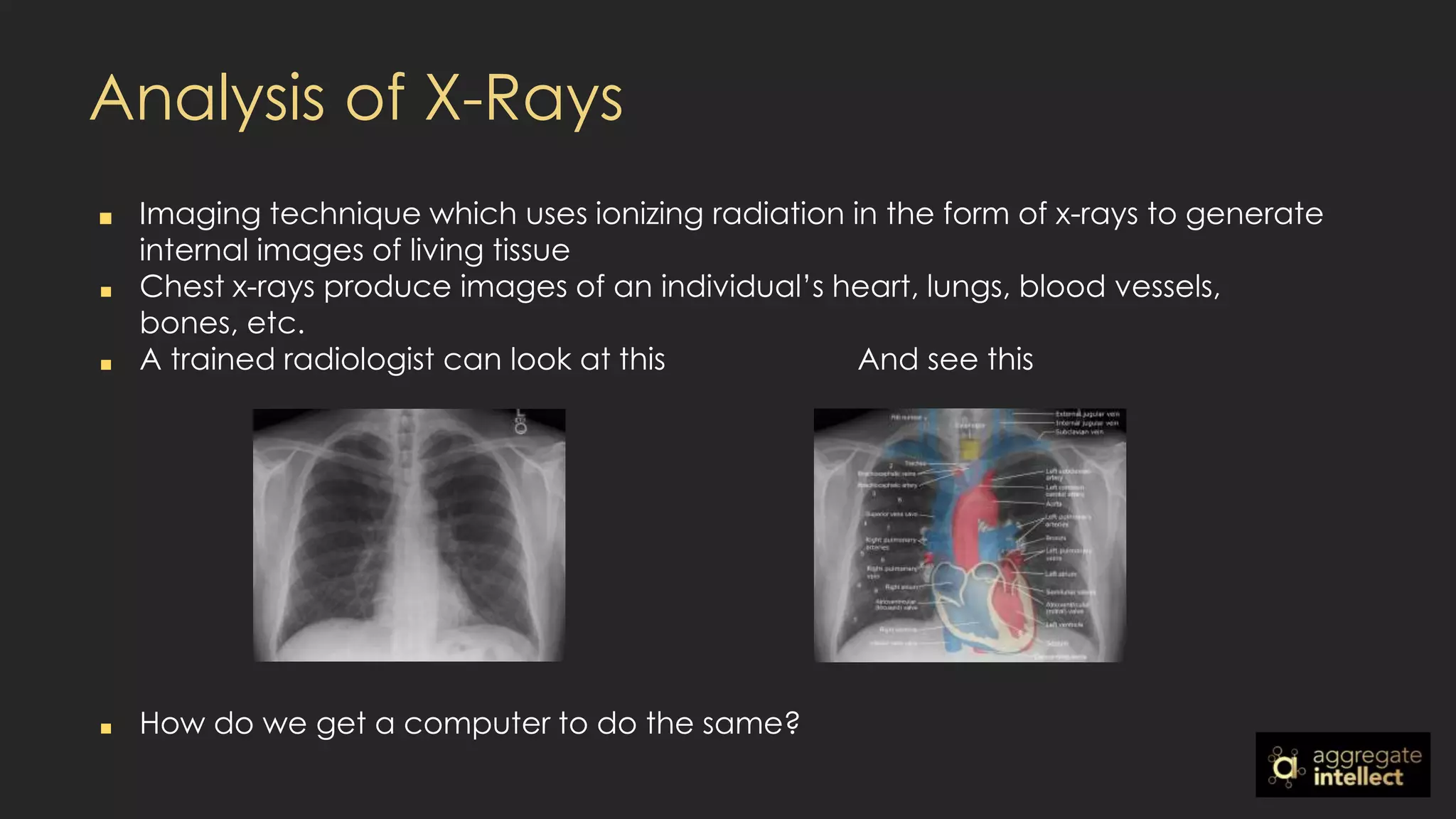 Progressive Transformer-Based Generation of Radiology Reports | PPTX