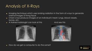 Progressive Transformer-Based Generation of Radiology Reports | PPTX