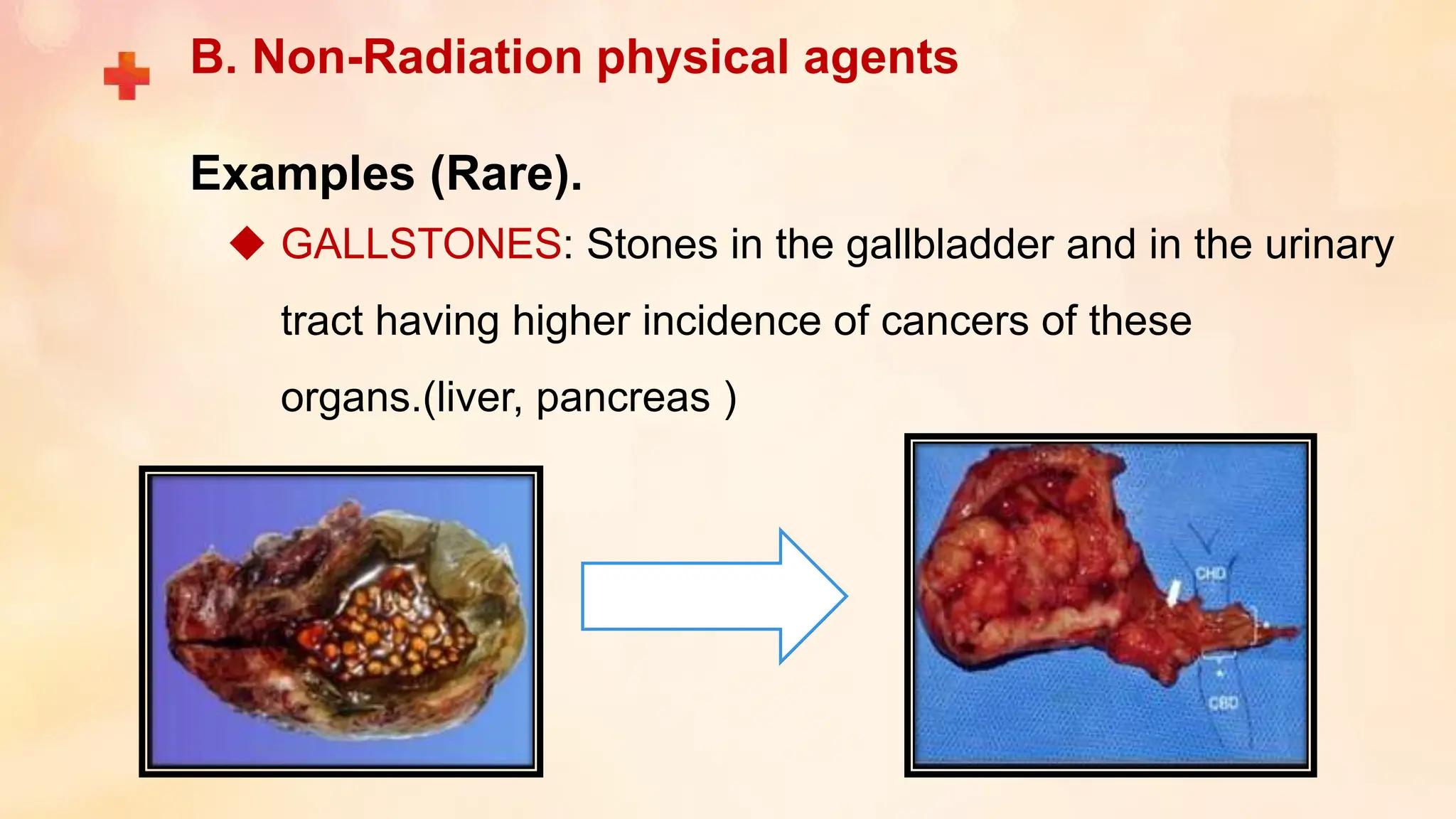 Carcinogens presentation ppt introduction of carcinogens and types of ...