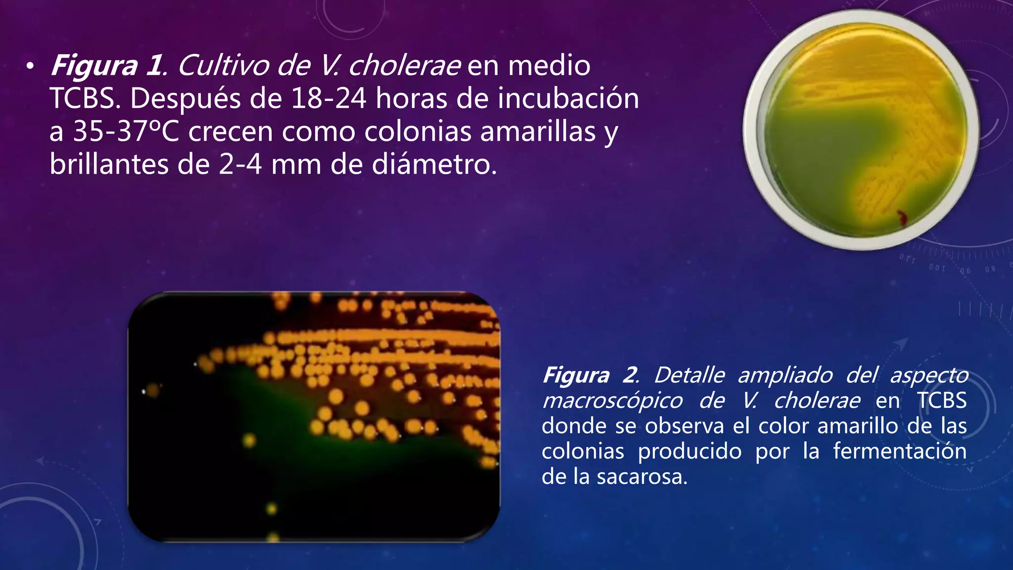 Aislamiento Del Vibrio Cholerae Ppt