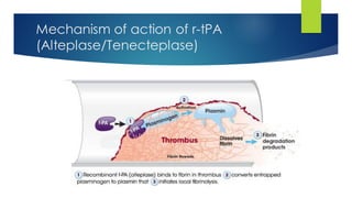 Acute Ischemic Stroke management protocol 2.pdf