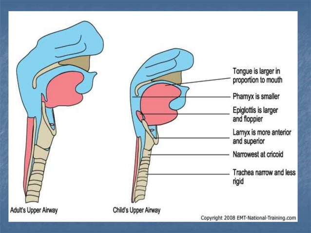basic airway management | PPTX | Ear, Nose and Throat Conditions ...