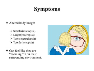 Alice in Wonderland Syndrome(AIWS) | PPTX