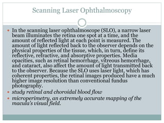 Lasers in ophthalmology | PPTX