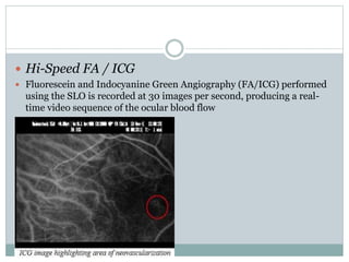 Lasers in ophthalmology | PPTX