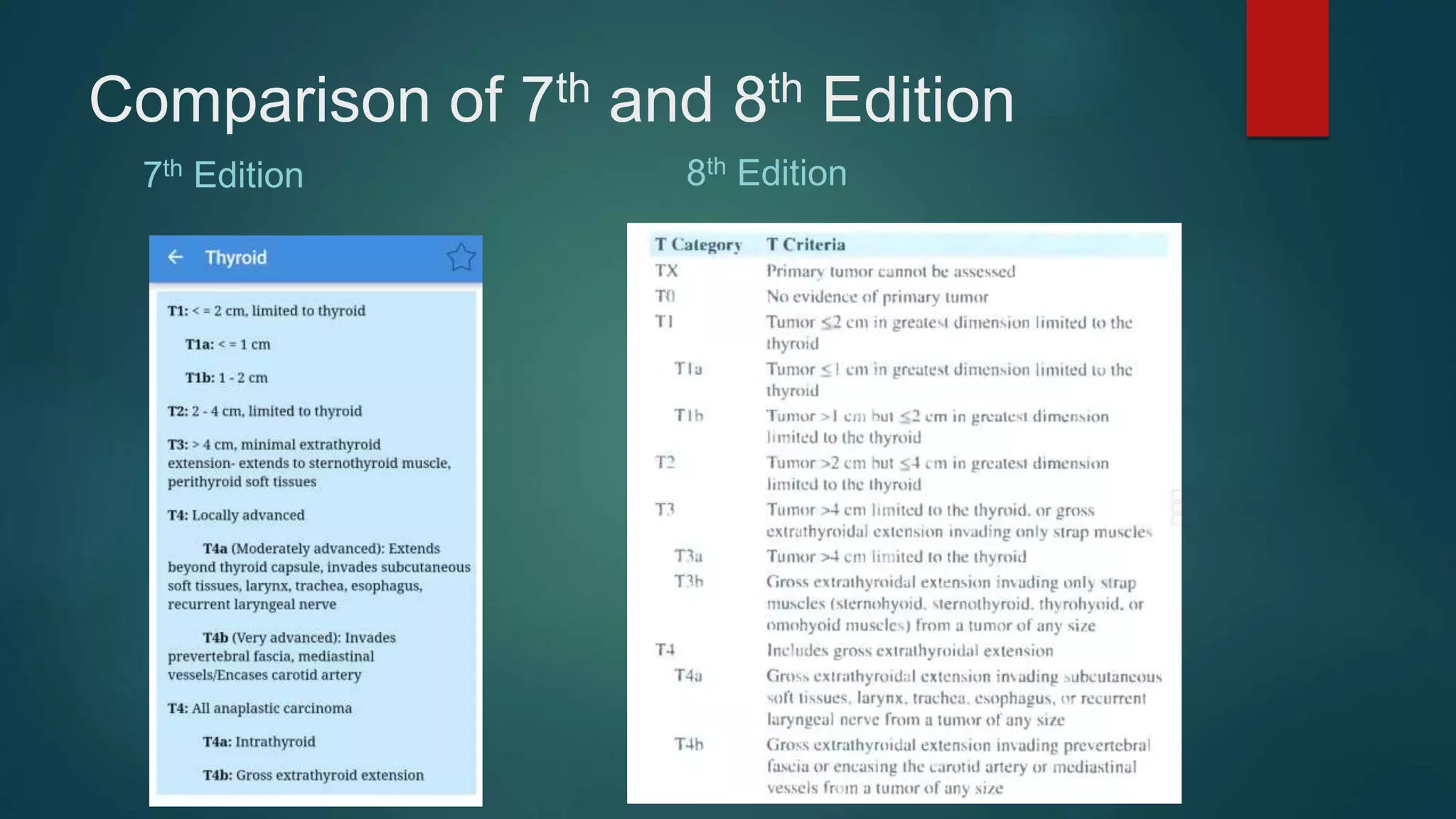 AJCC TNM staging of thyroid 8th edition ppt | PPTX