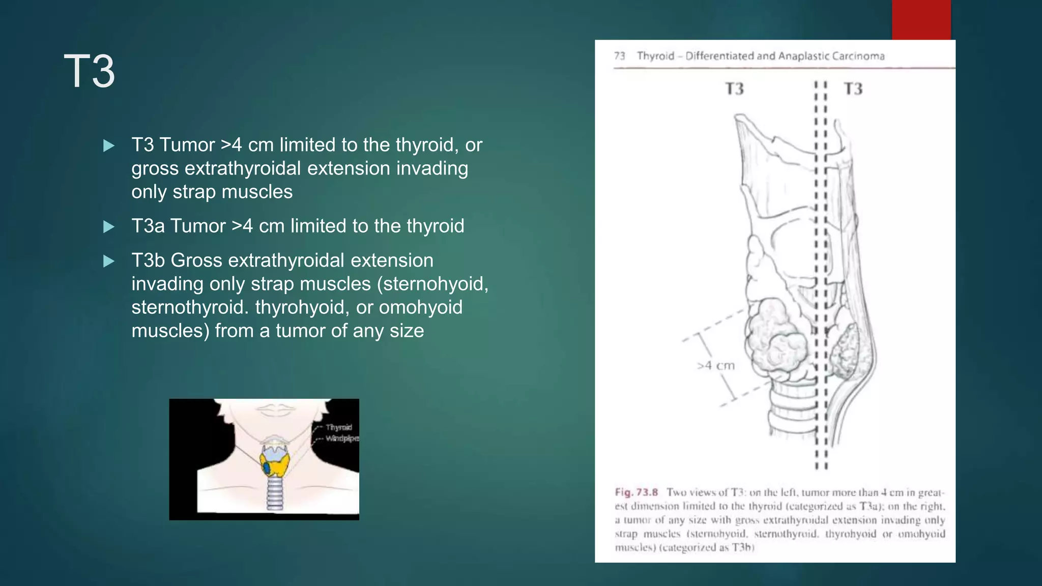 AJCC TNM staging of thyroid 8th edition ppt | PPTX