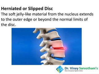 Care for your spine | PPSX