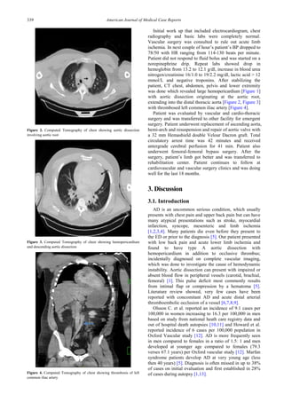 Aortic Dissection with Hemopericardium and Thrombosed Left Common Iliac ...