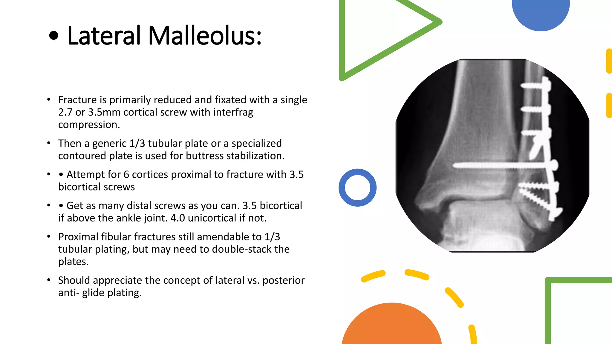 Ajm Sheet: Ankle Fracture | PPT