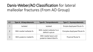 Ajm Sheet: Ankle Fracture | PPTX
