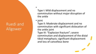 Ajm Sheet: Ankle Fracture | PPTX