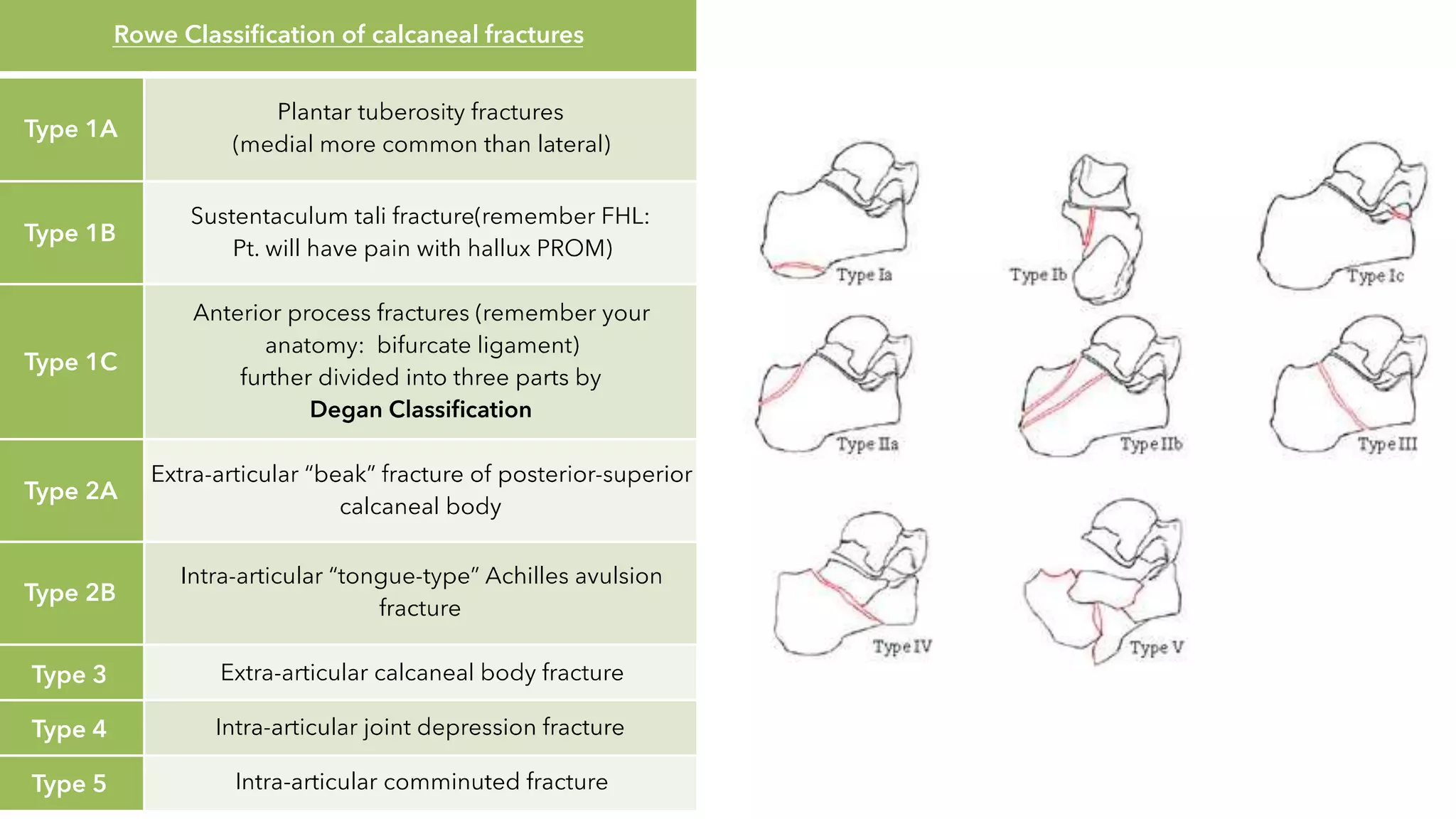 AJM Sheet: Calc Fracture | PPTX
