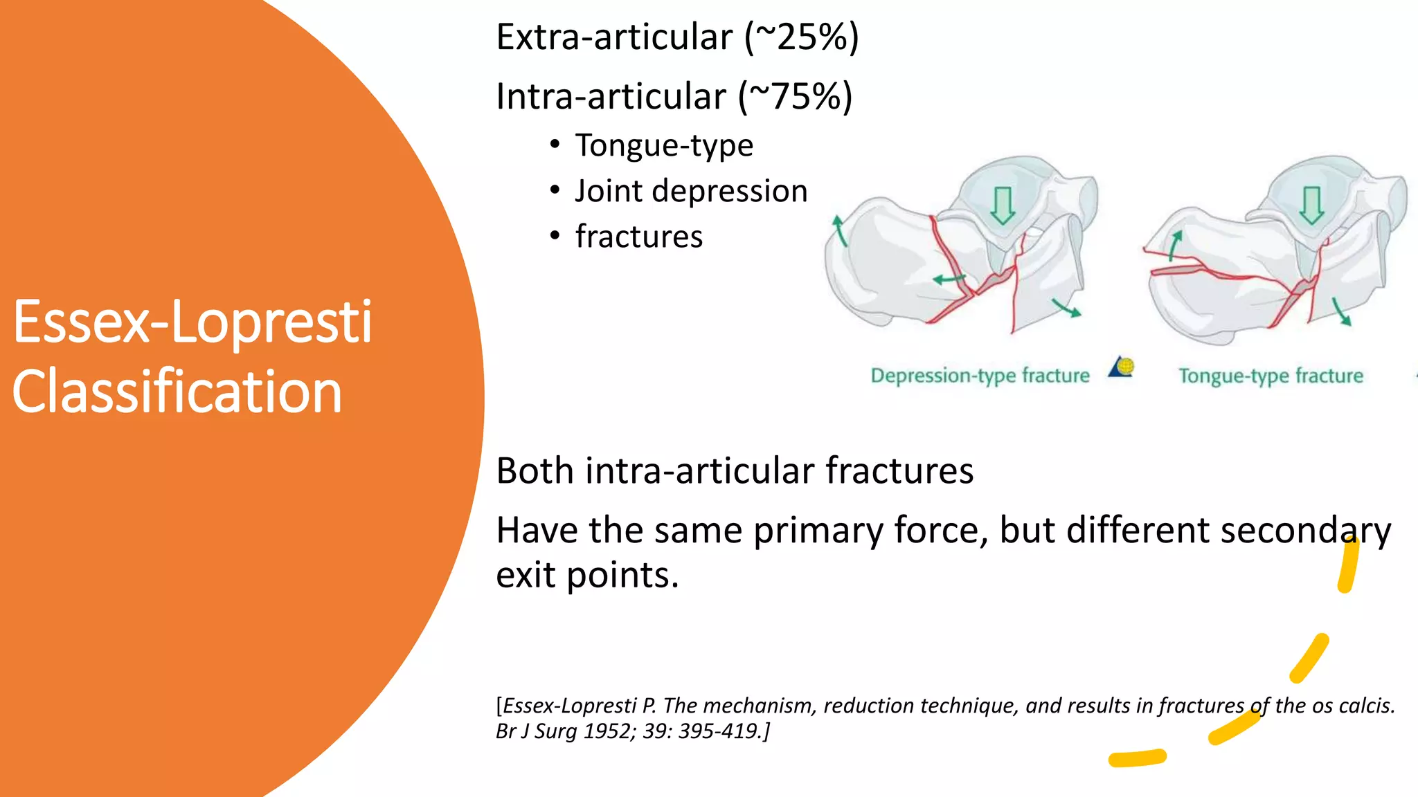 AJM Sheet: Calc Fracture | PPTX