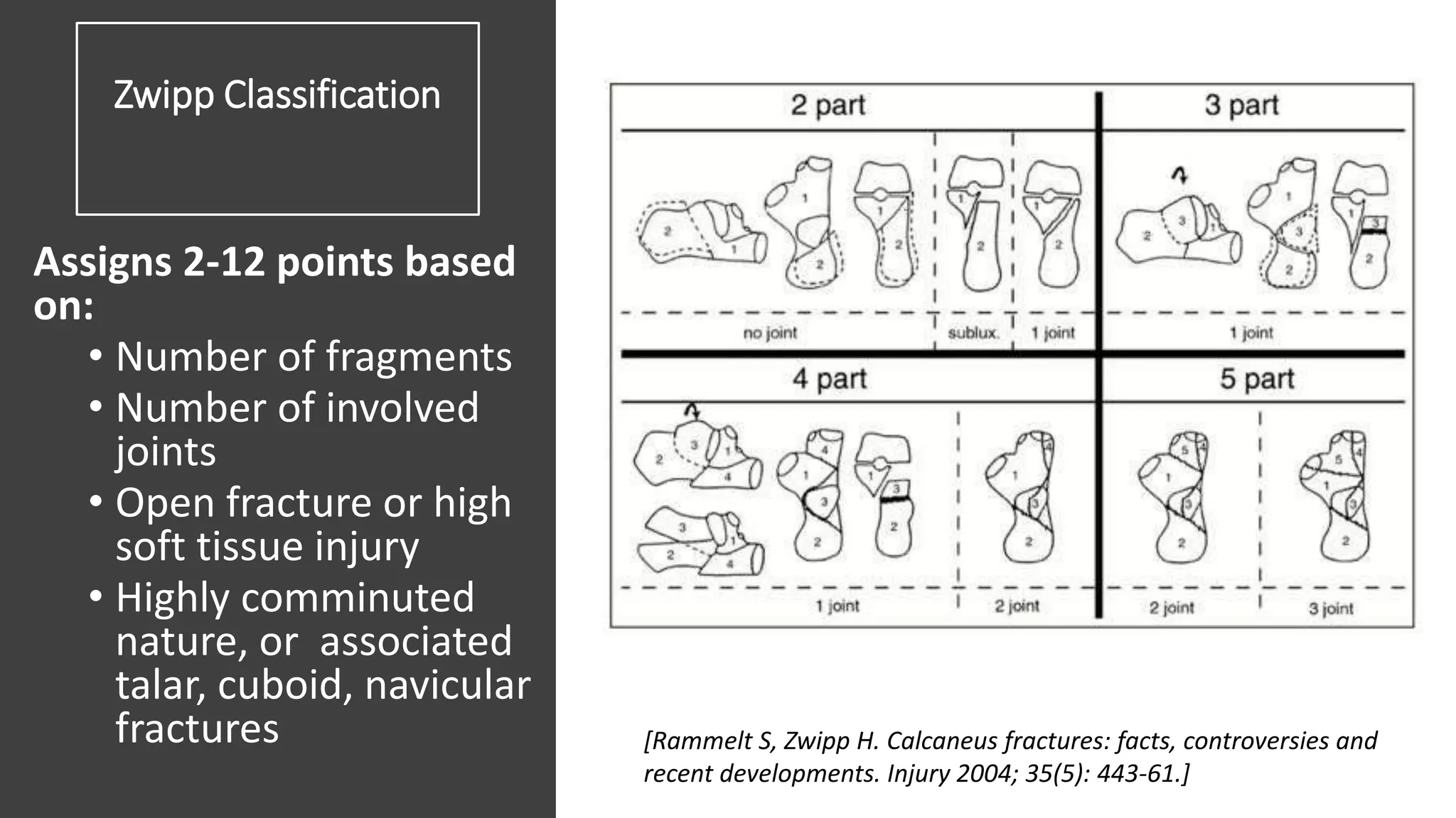 AJM Sheet: Calc Fracture | PPTX