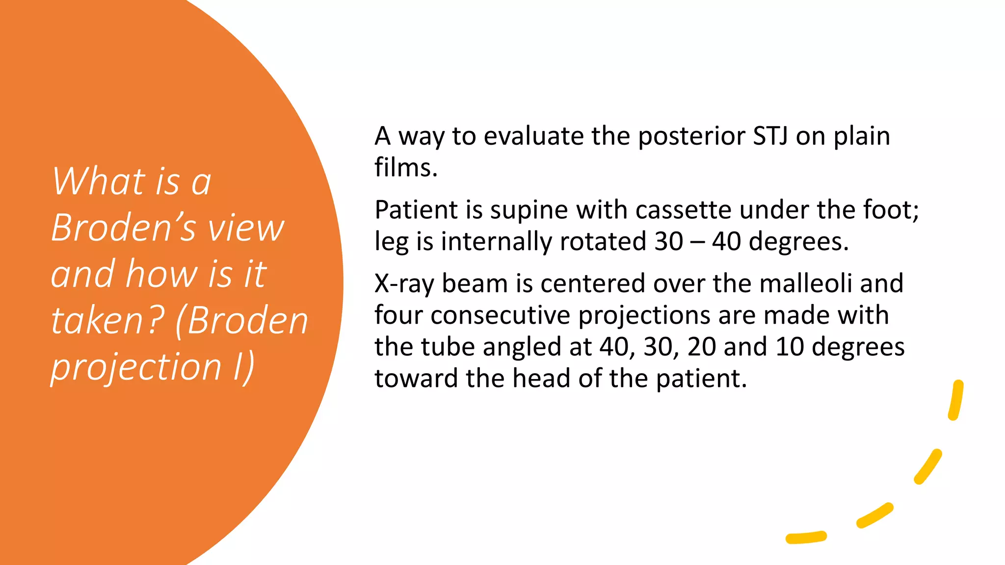 AJM Sheet: Calc Fracture | PPTX
