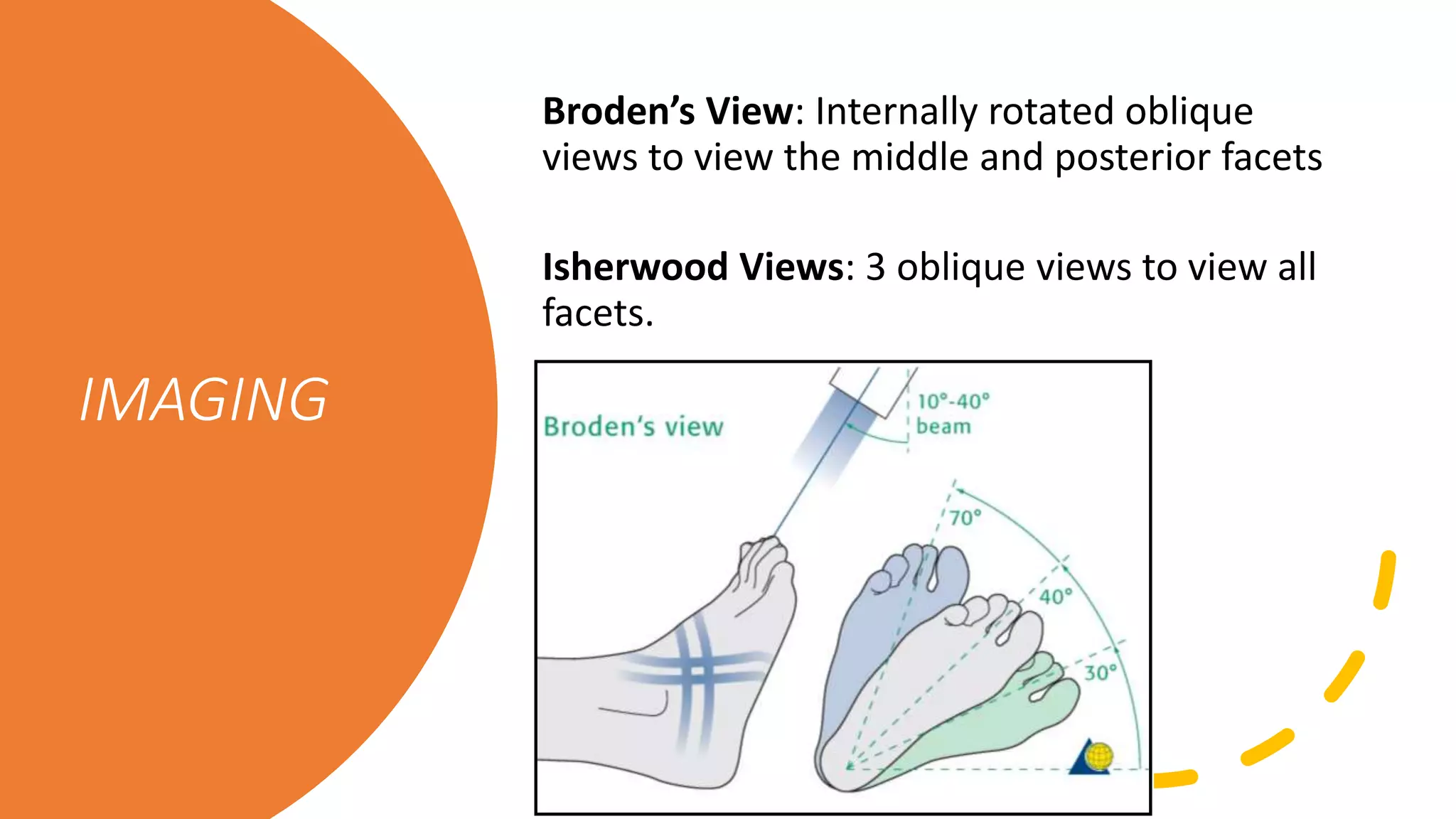 AJM Sheet: Calc Fracture | PPTX