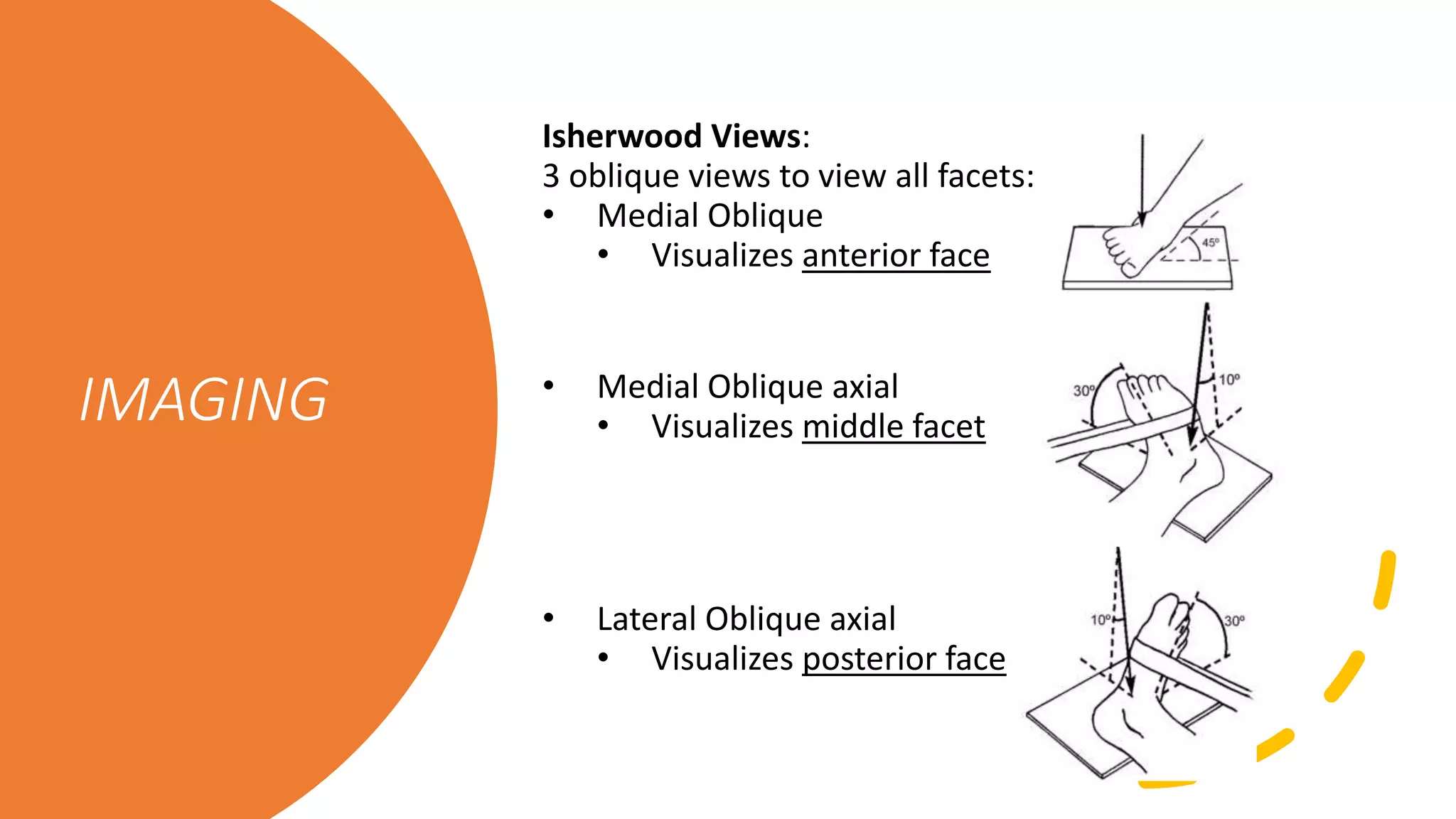 AJM Sheet: Calc Fracture | PPTX