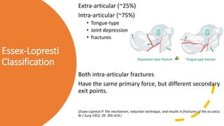 AJM SHEET: CALC FRACTURE | PPT