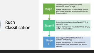 AJM Sheet: pes cavus | PPTX