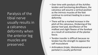 AJM Sheet: pes cavus | PPTX