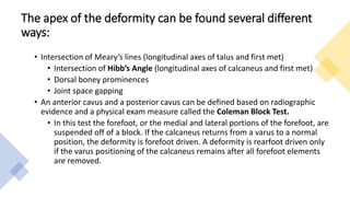AJM Sheet: pes cavus | PPTX