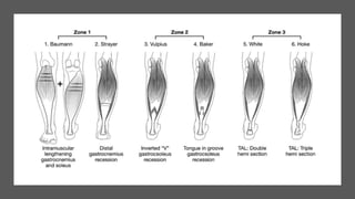 AJM Sheet: Ankle Equinus | PPTX