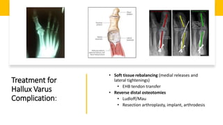 AJM SHEET HAV WORK-UP | PPT