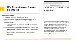 AJM SHEET HAV WORK-UP | PPT