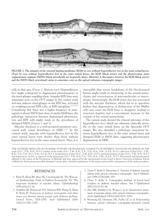 Hyprereflective foci in Diabetic Macular edema | PDF