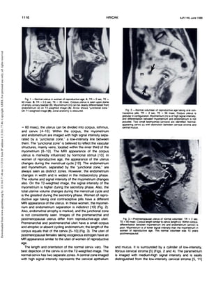 MRI of the Female Pelvis | PDF